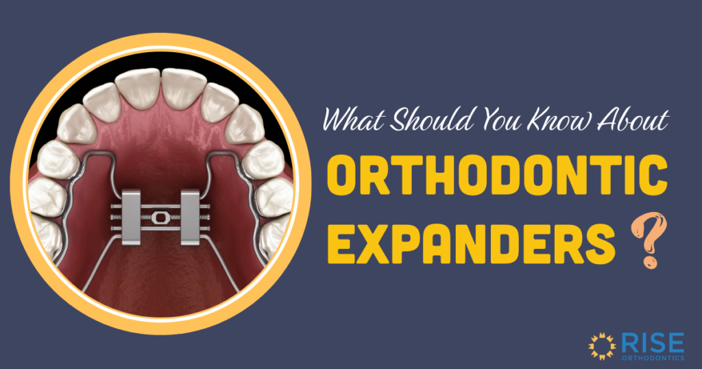 Understanding Orthodontic Expanders: A Comprehensive Guide